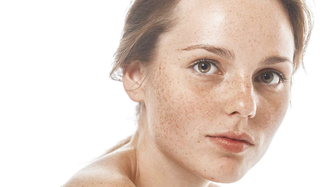 Seis curiosidades de las pecas que te harán entender que son hermosas