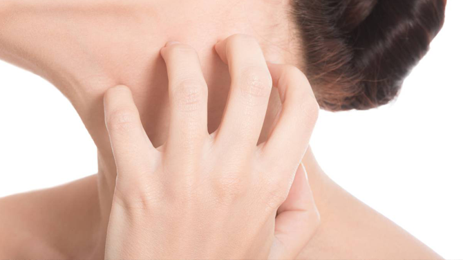 Dermografismo: ¿qué es y cómo se debe tratar?