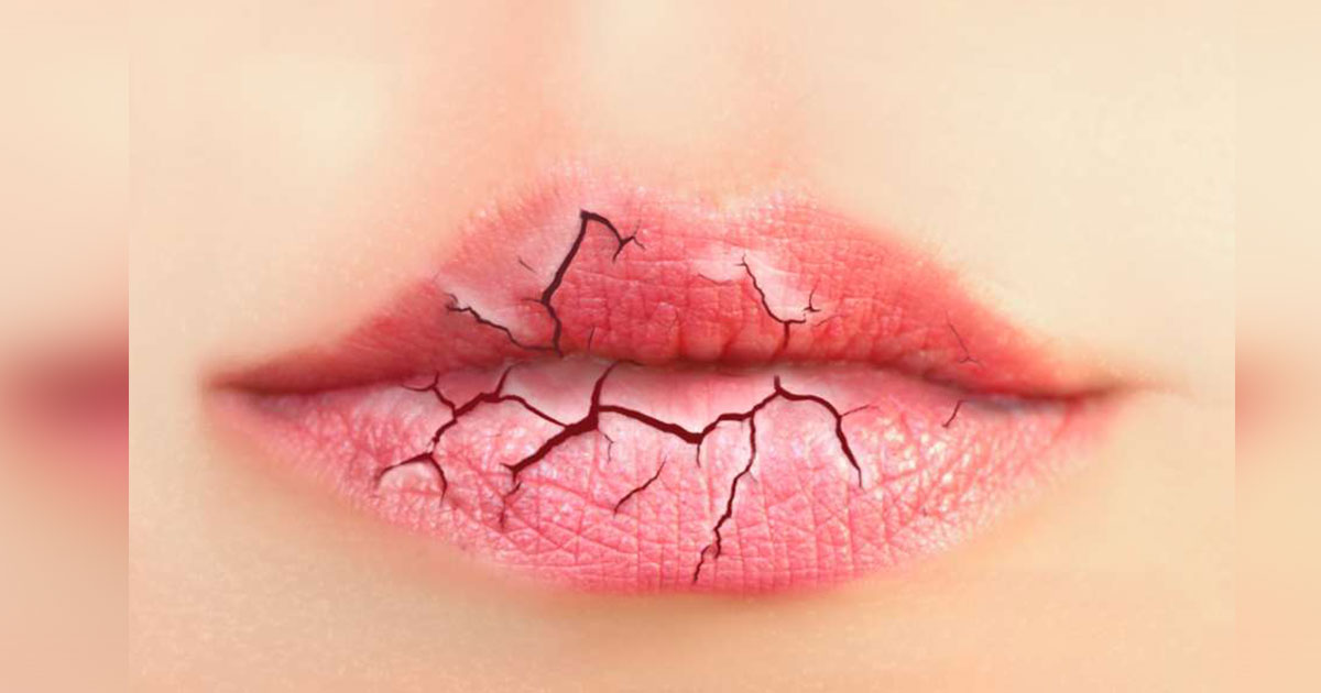 Refuerza la hidratación de tus labios con estos tips y evita la resequedad