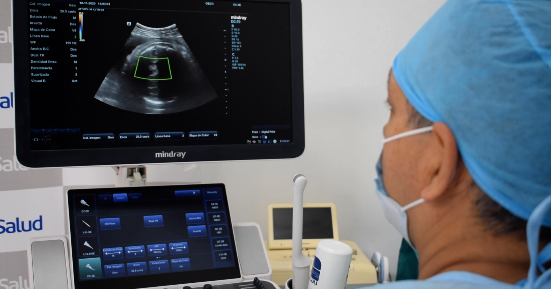 EsSalud presentó el "Plan Radar" para detectar embarazos de riesgo que ...