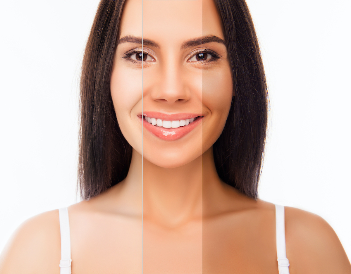 Los 5 Pasos Que Debes Seguir Para Regresar A Tu Tono Natural De Piel