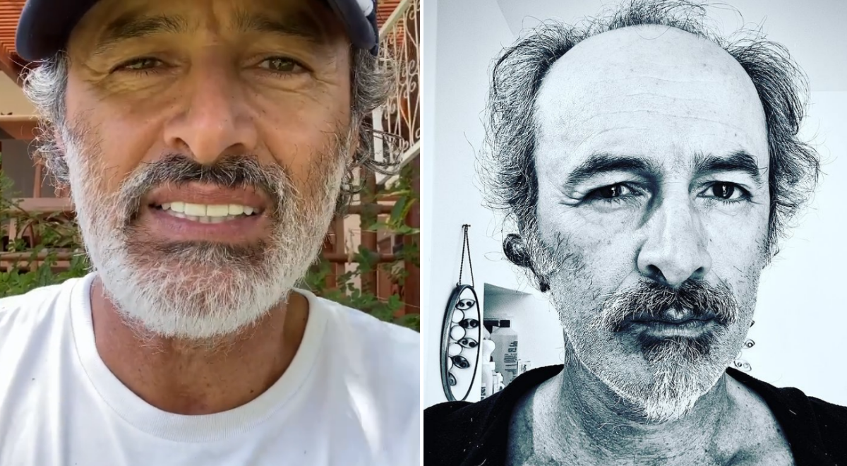 ¿qué Es El Glaucoma Carlos Alcántara Revela Que Padece Este Mal