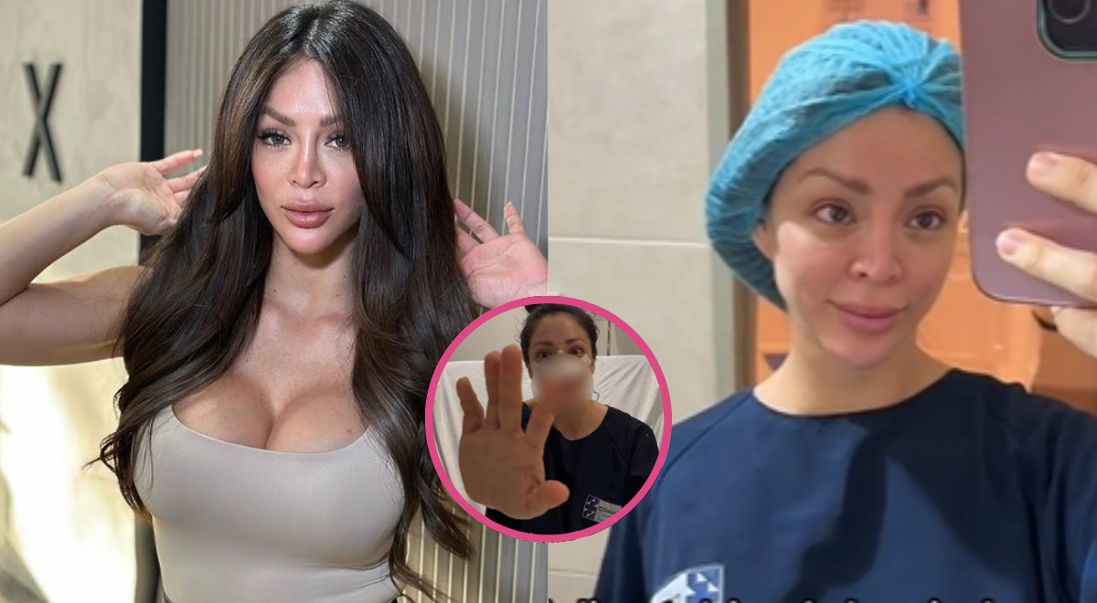 Sheyla Rojas anuncia en redes sociales que se sometió a una nueva cirugía plástica: “Todo salió ...