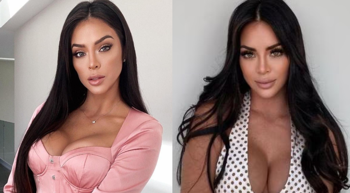 Sheyla Rojas sorprende al mostrar cómo quedó su nariz tras operación